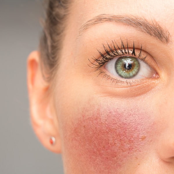 Medical Skin Conditions Dr Tina Fang Medical Skin Conditions Dr Tina Fang